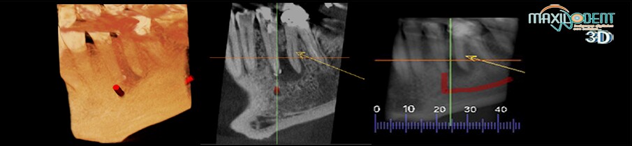MAXILODENT, Centro de Radiología Digital Oral y Maxilofacial ...