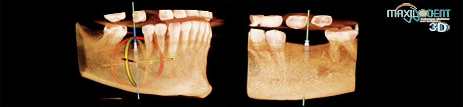 MAXILODENT, Centro de Radiología Digital Oral y Maxilofacial ...